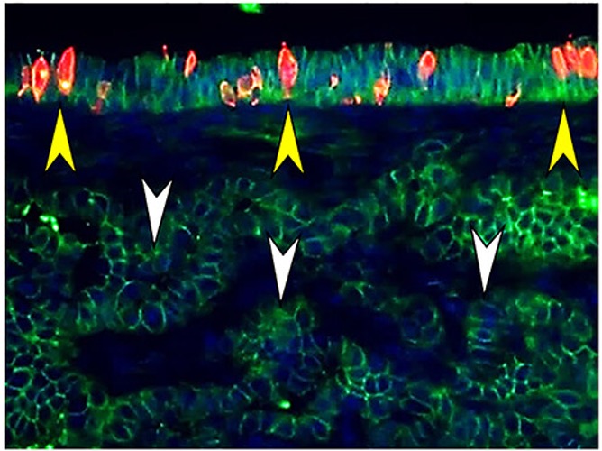 Dynamic tuft cell expansion during gastric metaplasia and dysplasia ...