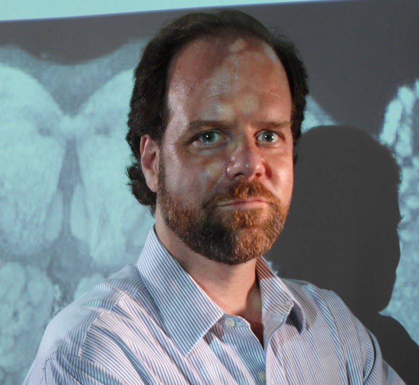 Kendal Broadie | Broadie Laboratory | Vanderbilt University