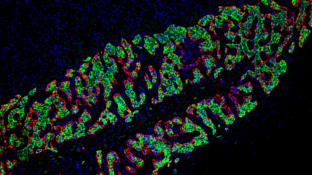 Human islet graft labeled for insulin (green) and glucagon (red ...