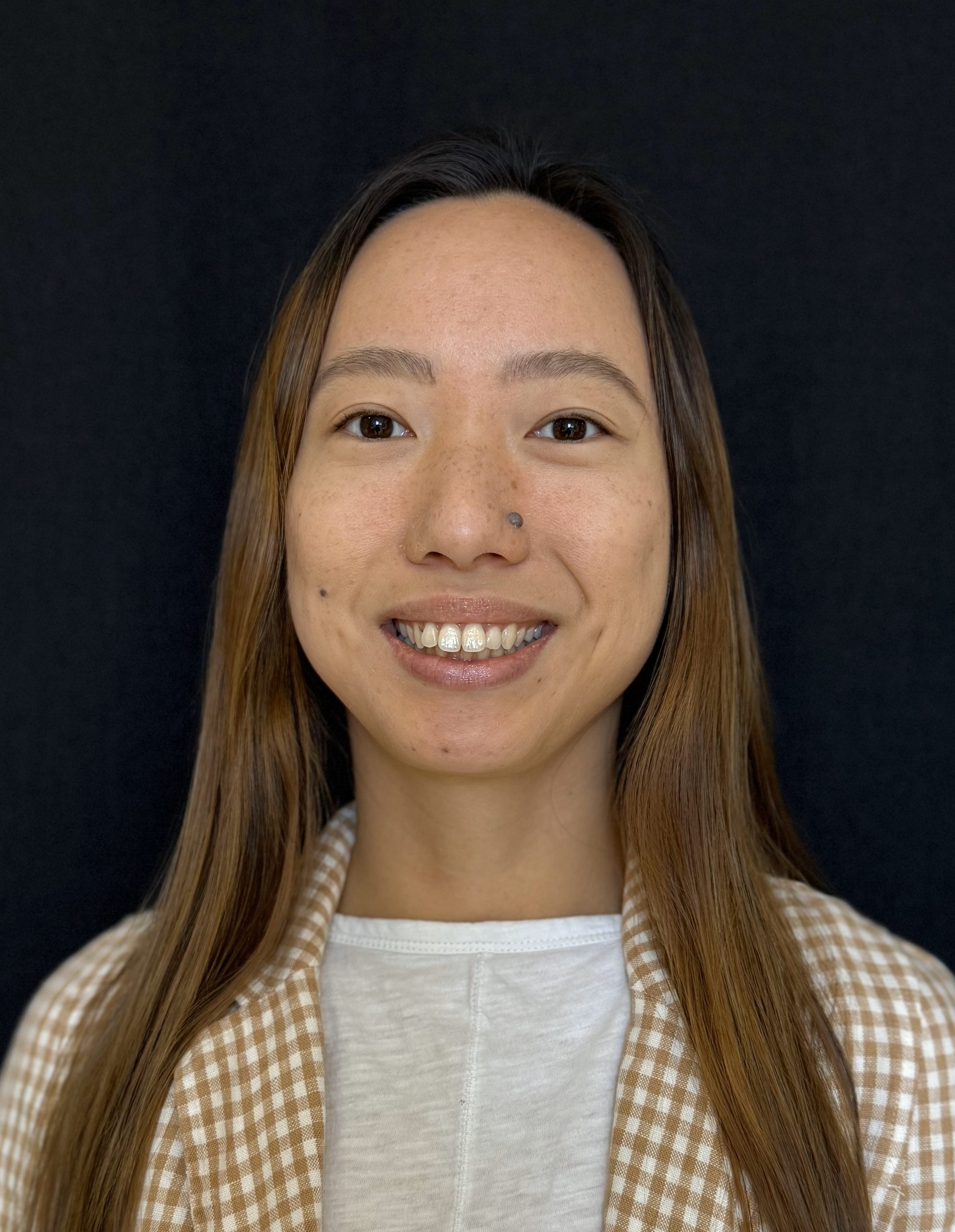 Fei Yang | Department of Pharmacology | Vanderbilt University