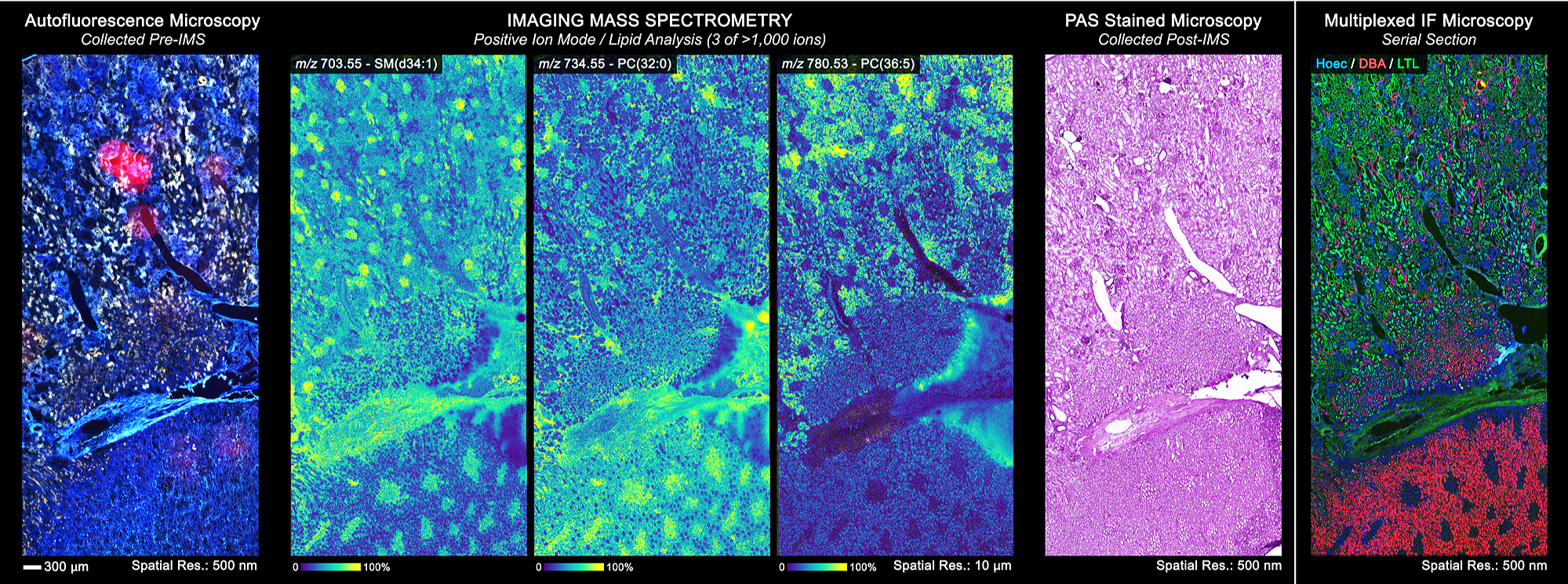 Home | BIOmolecular Multimodal Imaging Center | Vanderbilt University