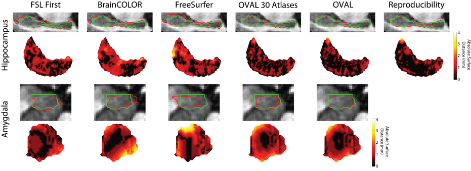 Automated, open-source segmentation of the Hippocampus and amygdala with the open Vanderbilt ...