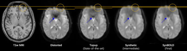 SynBOLD-DisCo: Synthetic BOLD images for distortion correction of fMRI without additional ...