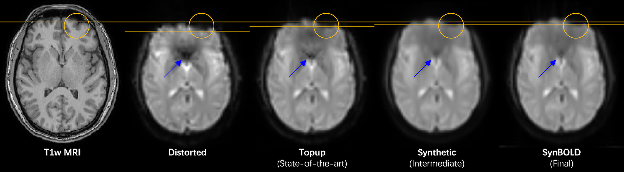 SynBOLD-DisCo: Synthetic BOLD images for distortion correction of fMRI without additional ...