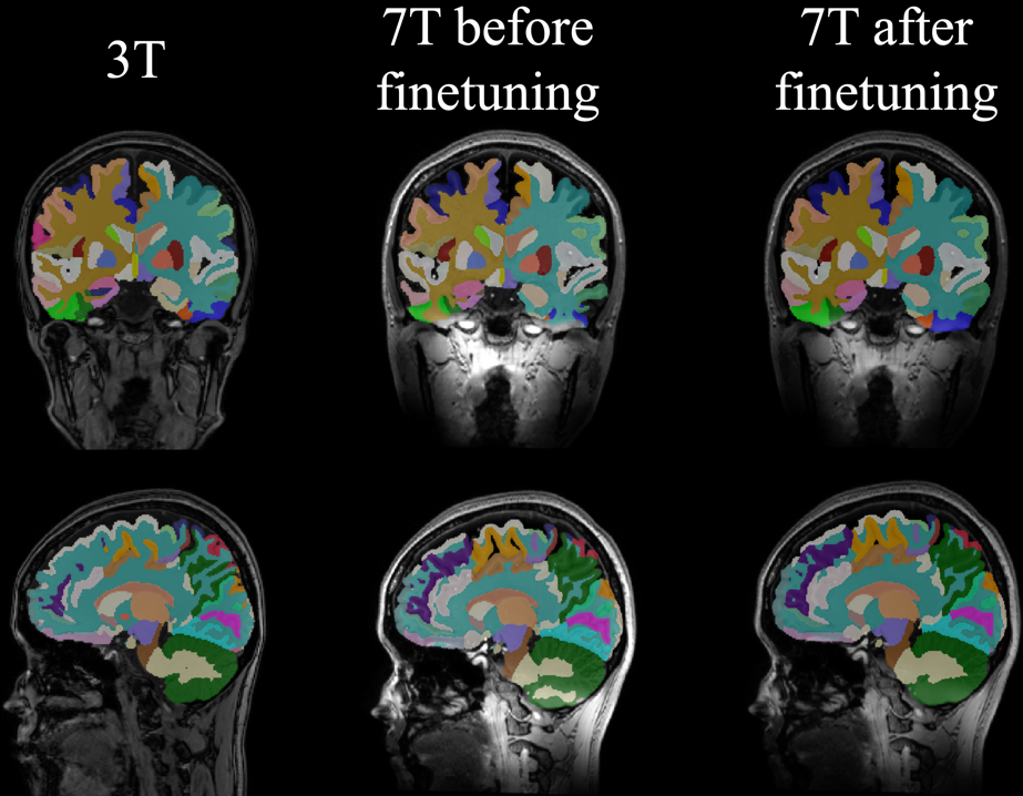 Deep whole brain segmentation of 7T structural MRI | Medical-image Analysis and Statistical ...