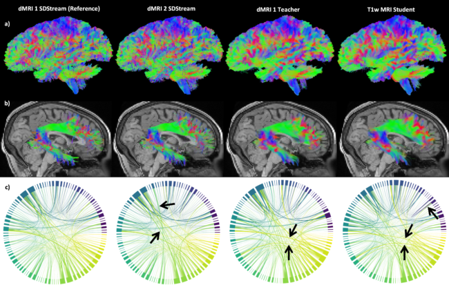 Convolutional-recurrent neural networks approximate diffusion tractography from T1-weighted MRI ...