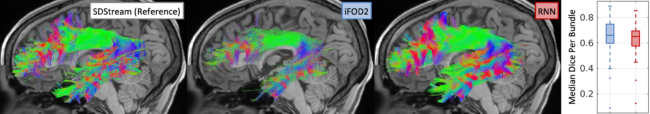 Implementation considerations for deep learning with diffusion MRI ...