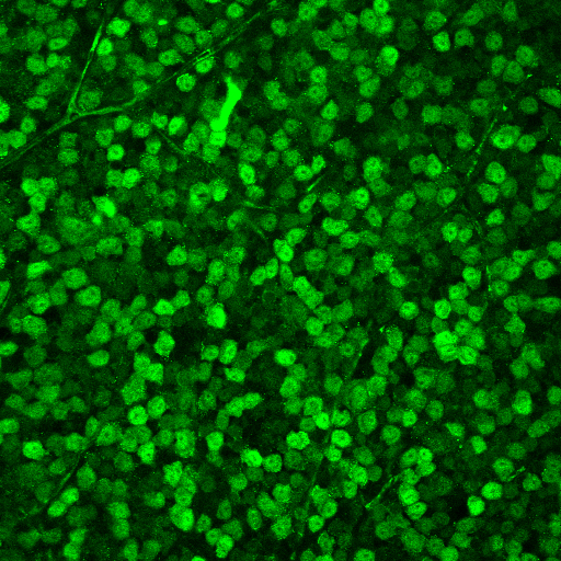 Young, non-glaucomatous DBA/2J