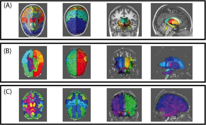 MASI_SEG | ACCRE | Vanderbilt University