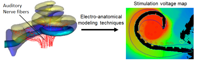 Model-based cochlear implant programming | Vanderbilt Institute for ...