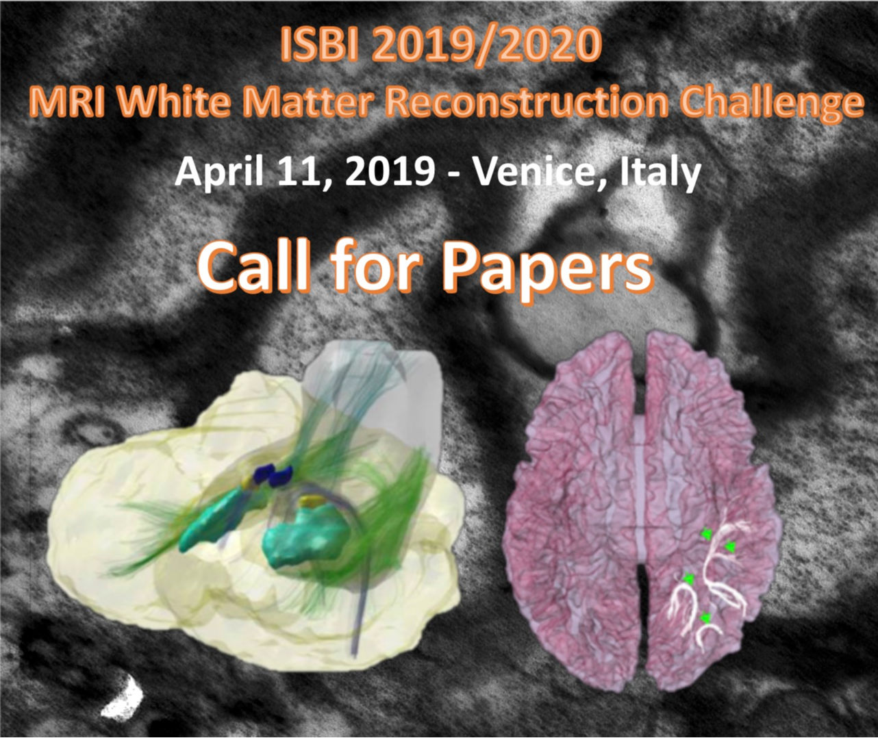 MASI Lab to host multi-year MRI white matter challenge | Vanderbilt ...