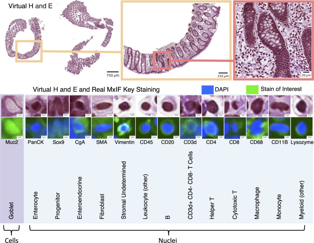 Data-driven nucleus subclassification on colon hematoxylin and eosin ...