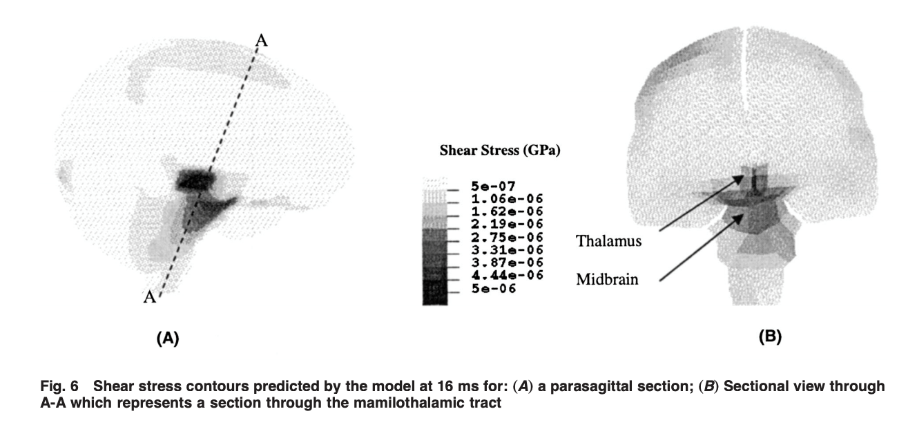 Progress Reports | Finite Element Model of the Brain | Vanderbilt ...