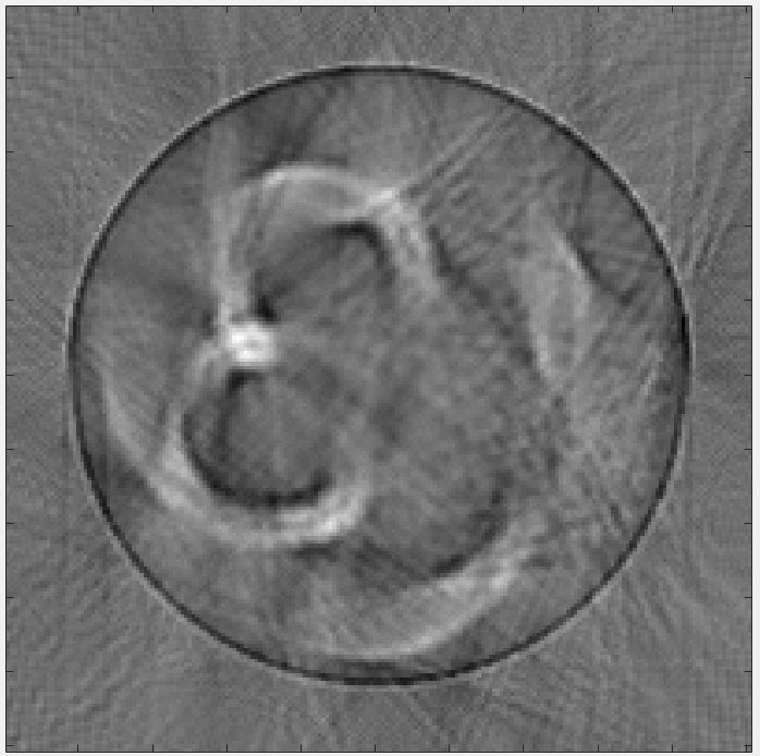Tanner Hoppman | Imaging Instrumentation, Spring 2020