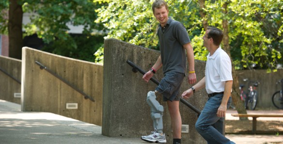 New ‘bionic’ leg gives amputees a natural gait | Vanderbilt University