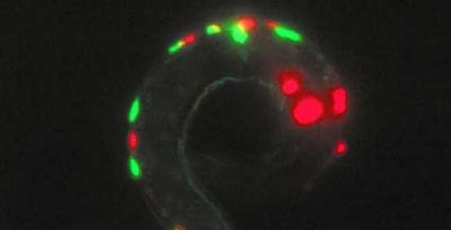 Worm gene function? Check the map. | Vanderbilt University