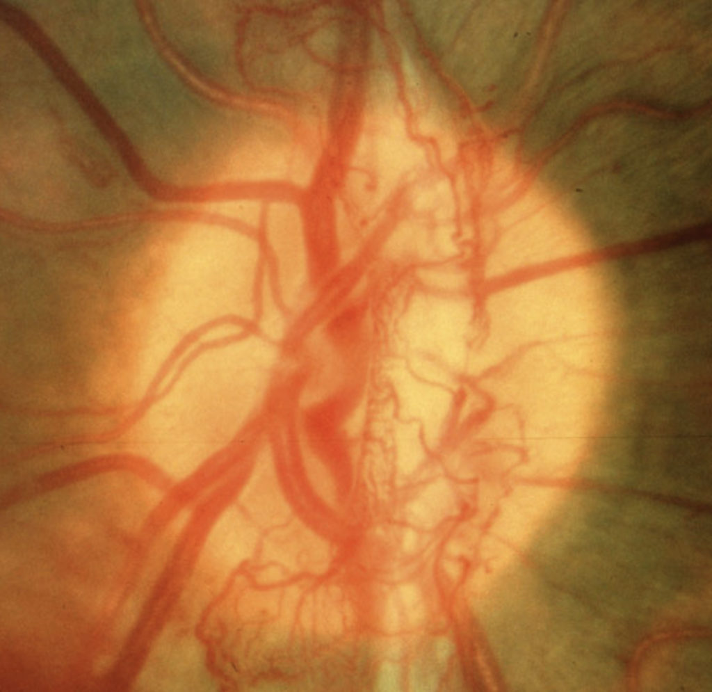Imaging-Photo | Uddin Laboratory for Ocular Imaging | Vanderbilt University