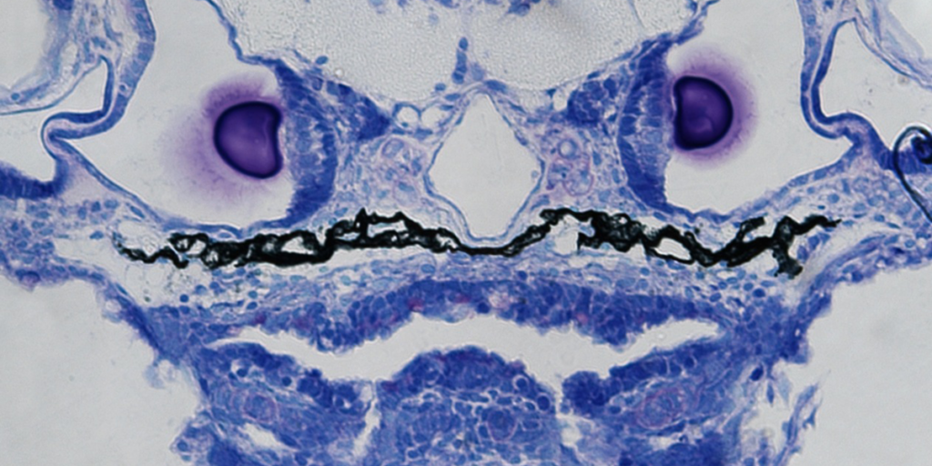 Human Genetics | Interdisciplinary Graduate Program | Vanderbilt University