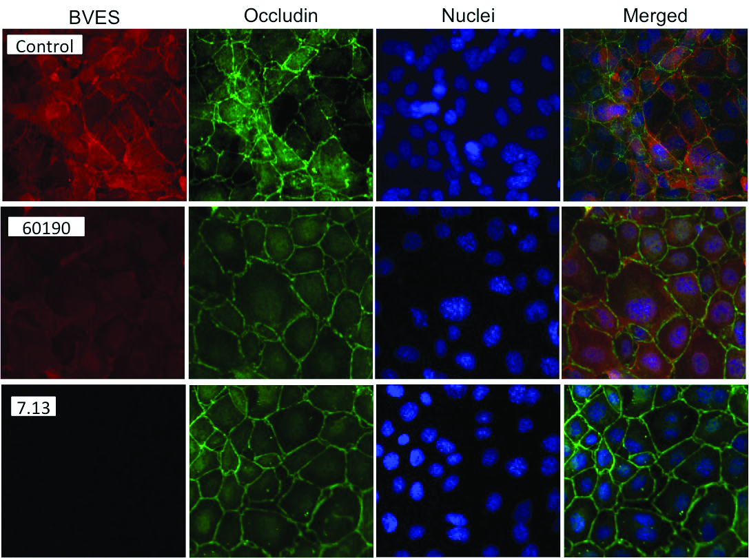 Helicobacter pylori Alters the Tight Junction-Regulating Adhesion ...