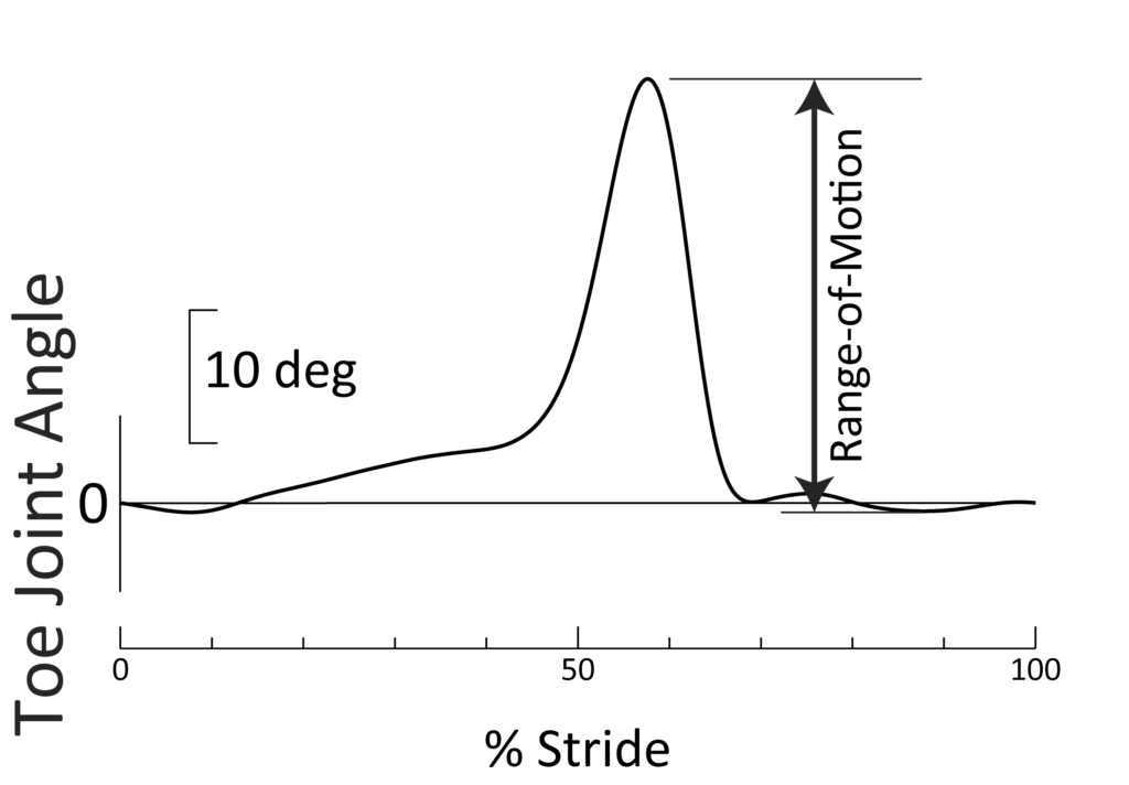 The Biomechanics of Walking and Turning With a Split Toe Prosthesis ...