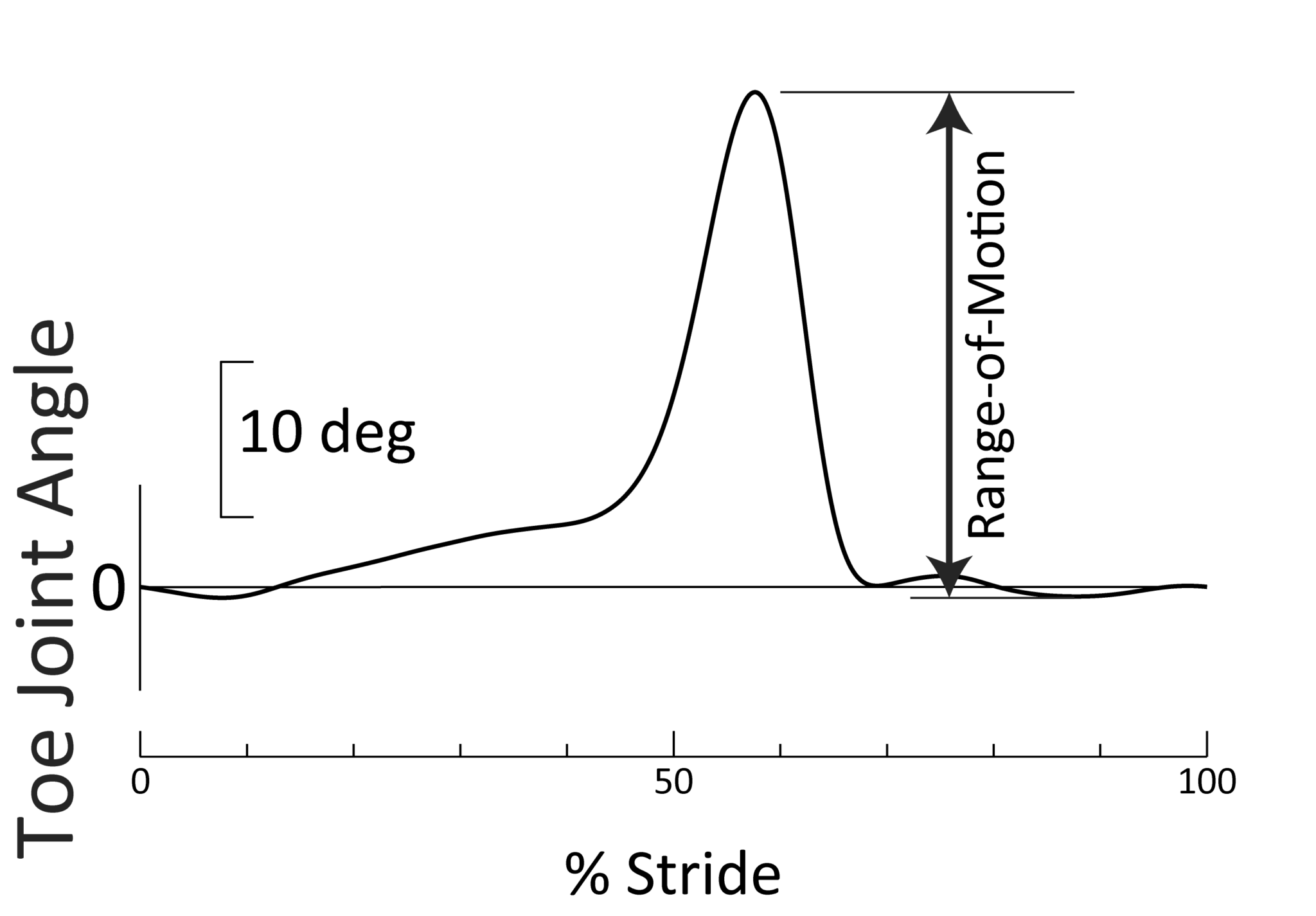 The Biomechanics of Walking and Turning With a Split Toe Prosthesis ...